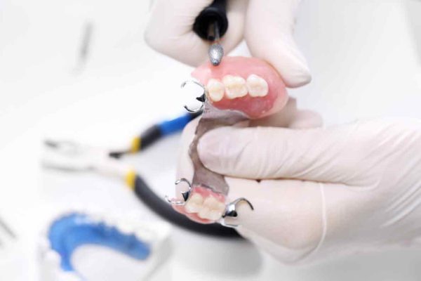 Dentures Chiangmai | Prosthodontic Dentistry at CIDC Dental Clinic
