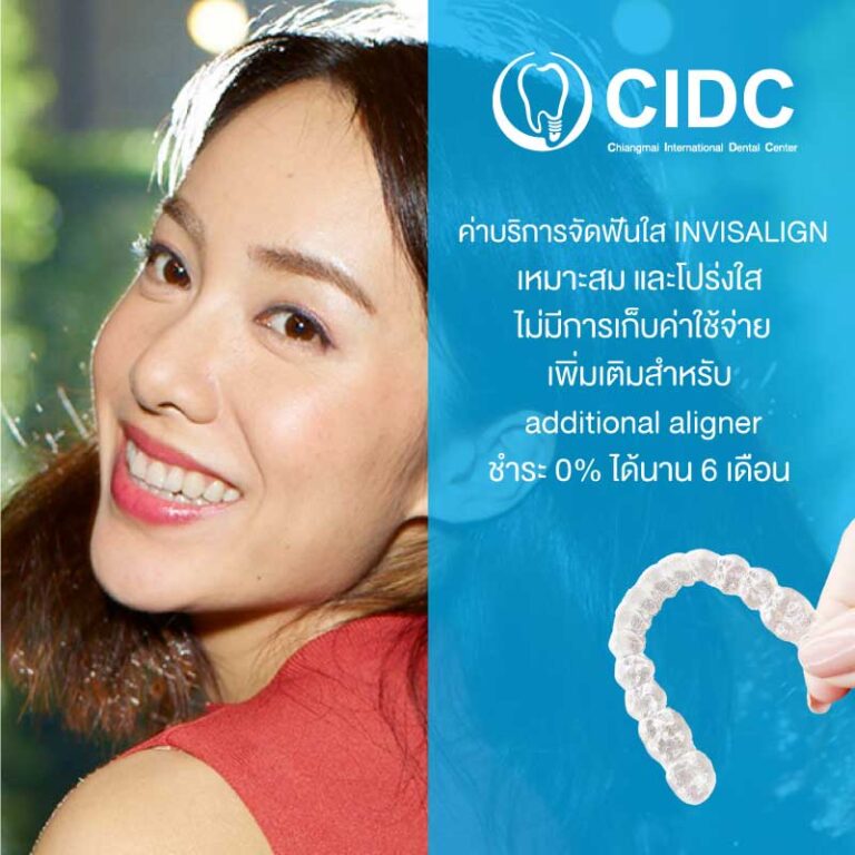 5 เหตุผลที่ควร จัดฟันใส Invisalign กับหมอเฉพาะทาง - เชียงใหม่ CIDC